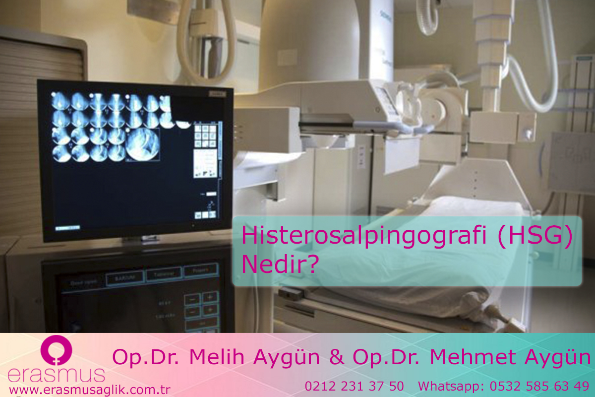 Histerosalpingografi (HSG) - Erasmus Üreme ve Kadın Sağlığı